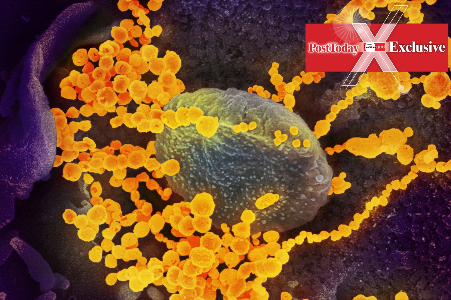 โควิด-19 อาจวิวัฒนาการนานหลายปีก่อนโจมตีอู่ฮั่น แต่มันมาจากไหน?