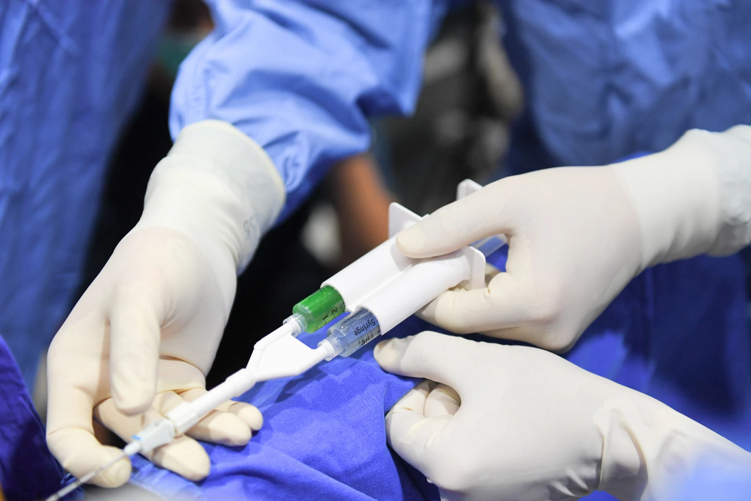 Innovative Hydrogel Injection for Prostate Cancer Patients: A Game ...